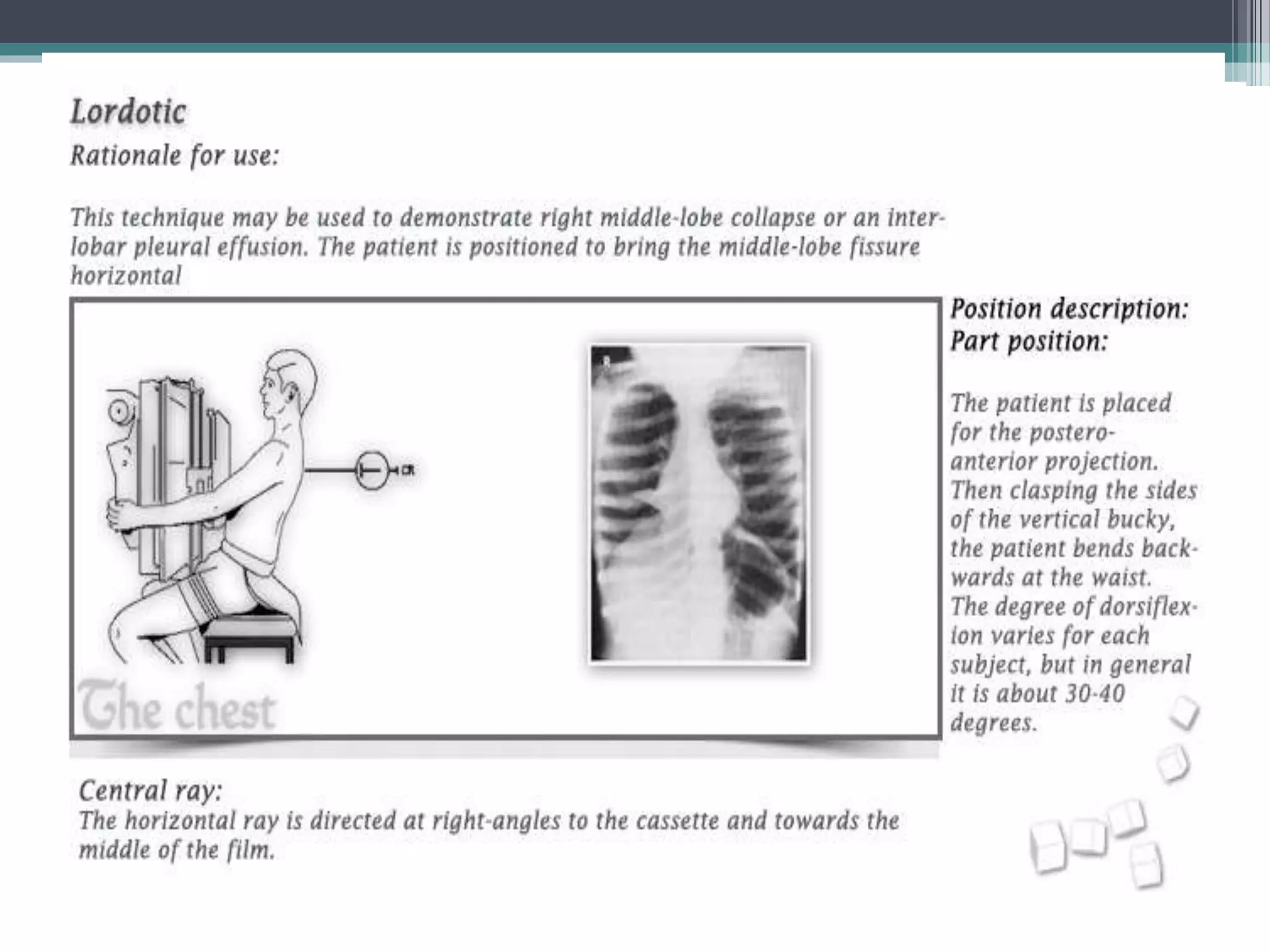 Chest x ray positioning | PPTX