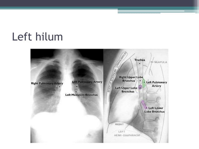 Chest x ray positioning | PPTX | Lung and Respiratory Health | Diseases ...