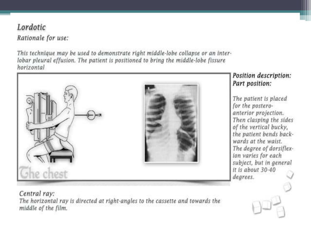 Chest x ray positioning | PPTX | Lung and Respiratory Health | Diseases ...
