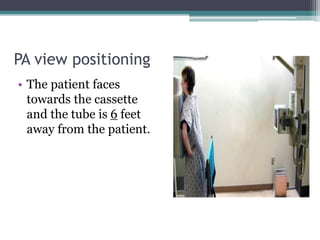 Chest x ray positioning | PPTX