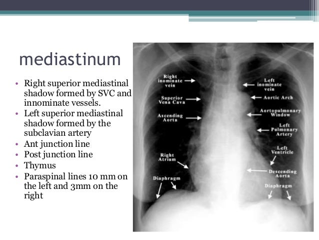 Chest x ray positioning