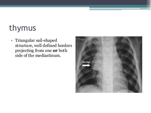 Chest x ray positioning