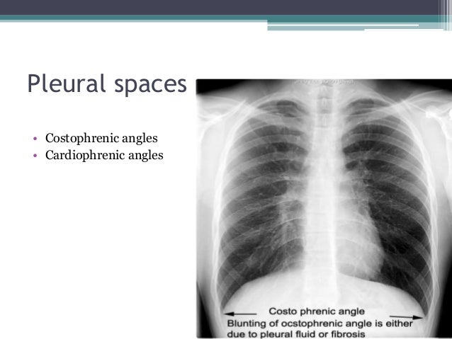 Chest x ray positioning