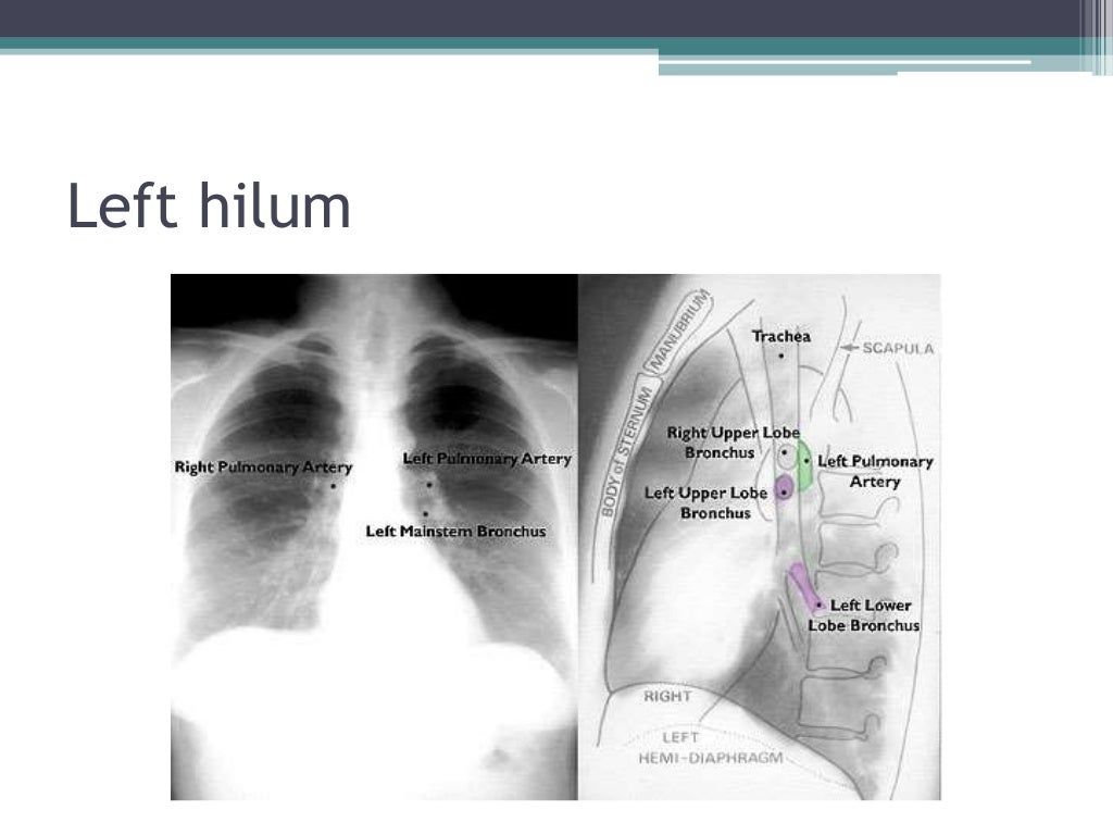 Chest x ray positioning