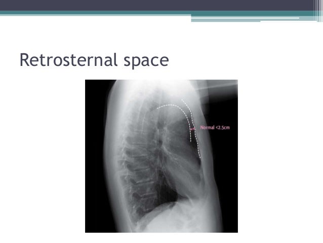 Chest x ray positioning