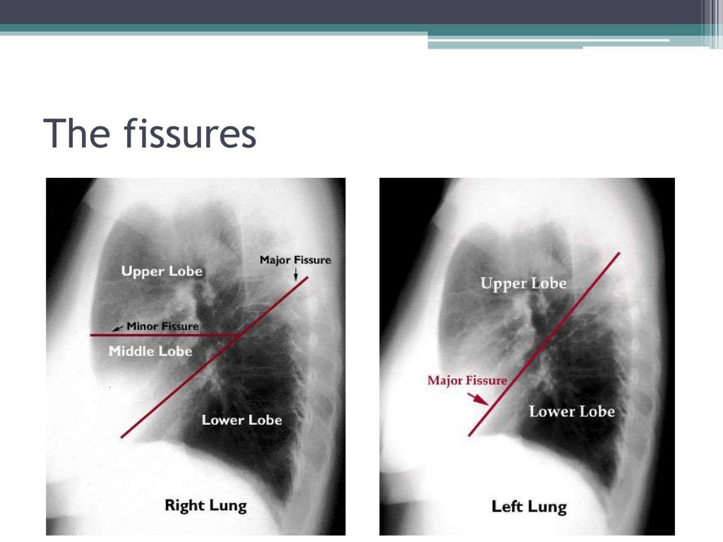 Chest x ray positioning