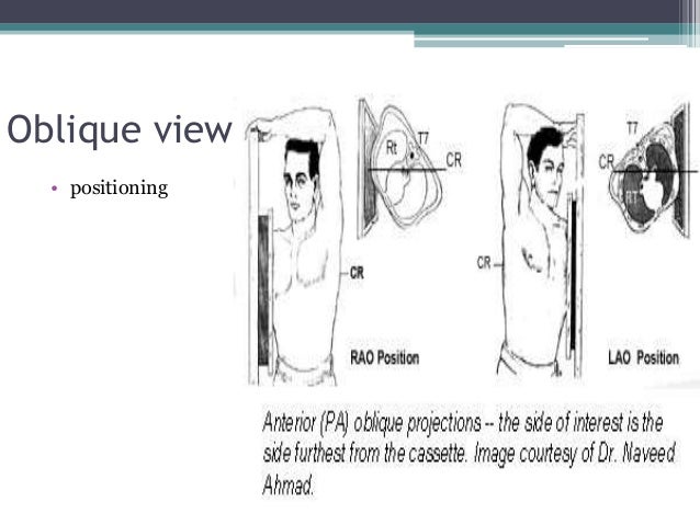 Chest x ray positioning