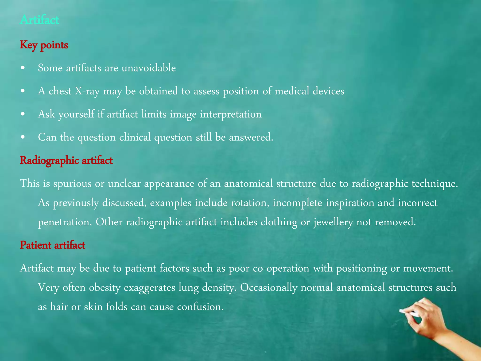 Chest x ray quality - how to interpret chest x-ray (1) | PPTX
