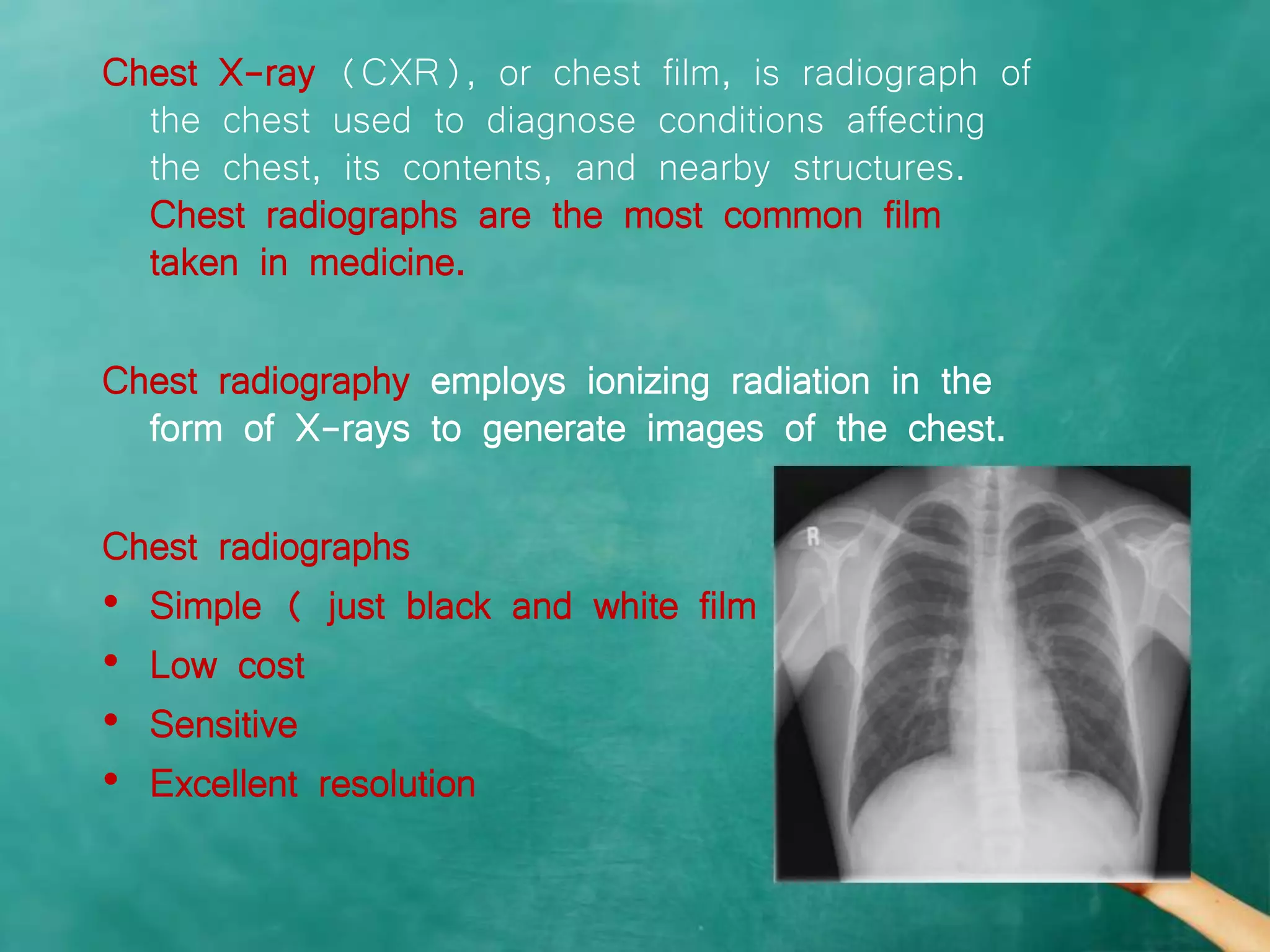 Chest x ray quality - how to interpret chest x-ray (1) | PPTX