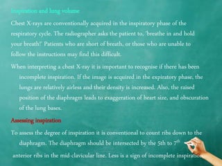 Chest x ray quality - how to interpret chest x-ray (1) | PPTX