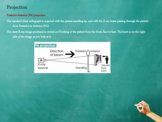 Chest x ray quality - how to interpret chest x-ray (1) | PPTX