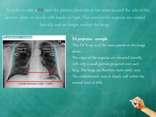 Chest x ray quality - how to interpret chest x-ray (1) | PPTX