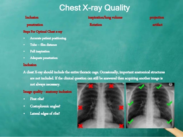 Chest x ray quality - how to interpret chest x-ray (1)
