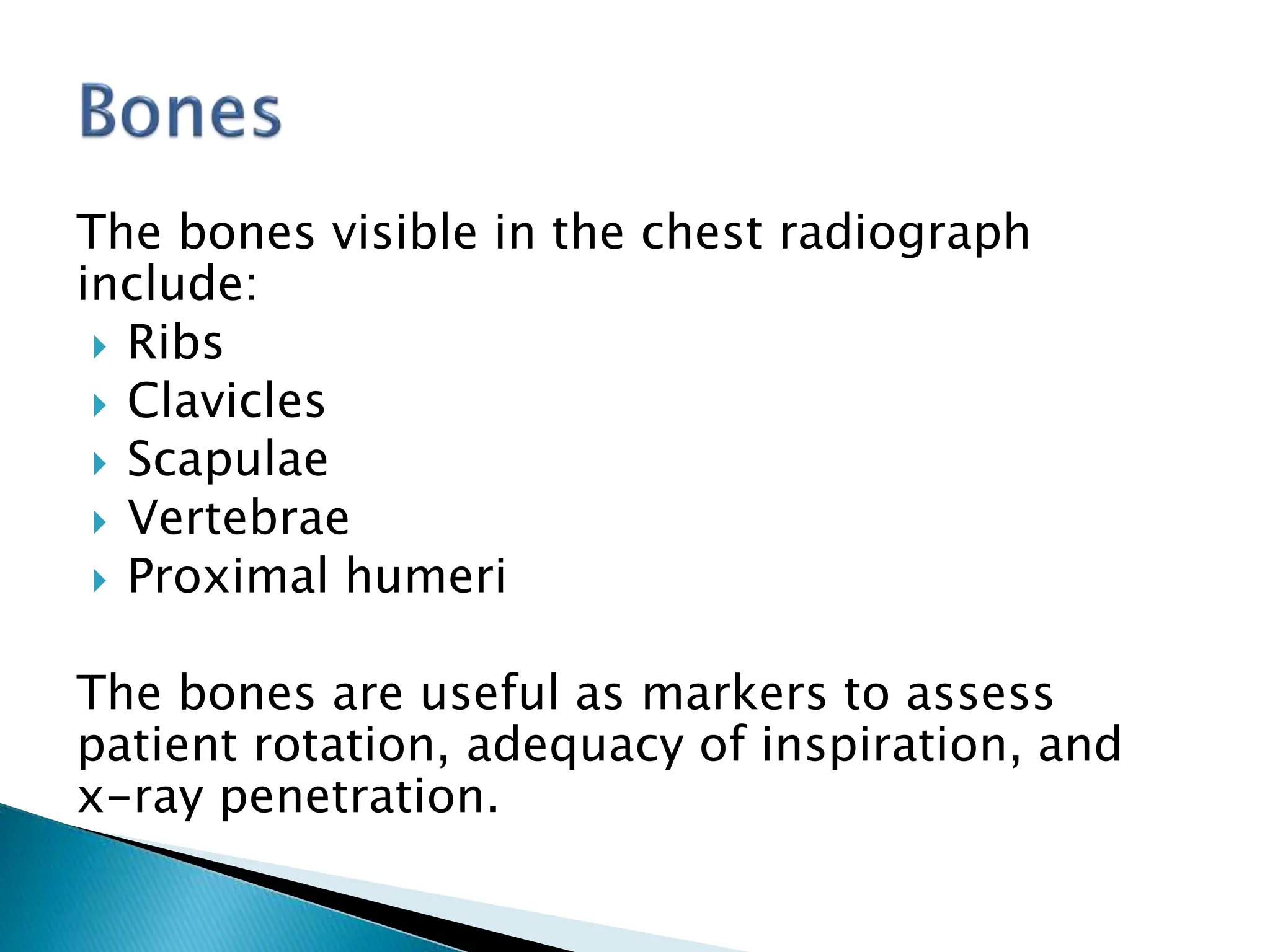 Chest X-ray radiology_Power Point Presentation | PPTX