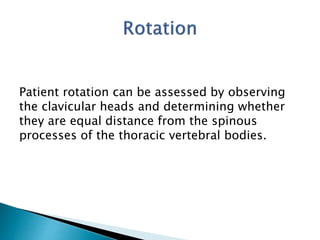 Chest X-ray radiology_Power Point Presentation | PPTX