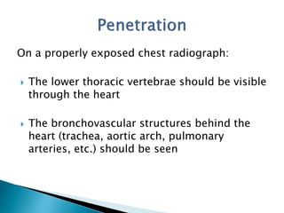 Chest X-ray radiology_Power Point Presentation | PPTX
