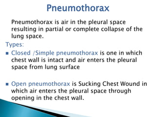 Chest X-ray radiology_Power Point Presentation | PPTX