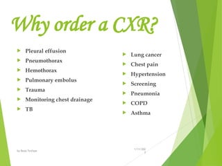 Chest X-Ray Review for 2nd year Radiology student.ppt