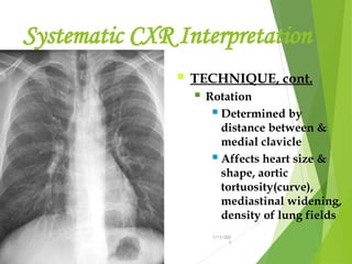 Chest X-Ray Review for 2nd year Radiology student.ppt