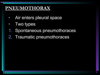 Chest x rays | PPT
