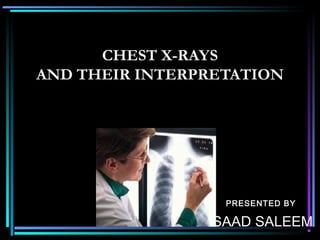 Chest x rays | PPT
