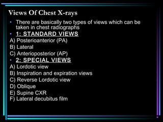 Chest x rays | PPT