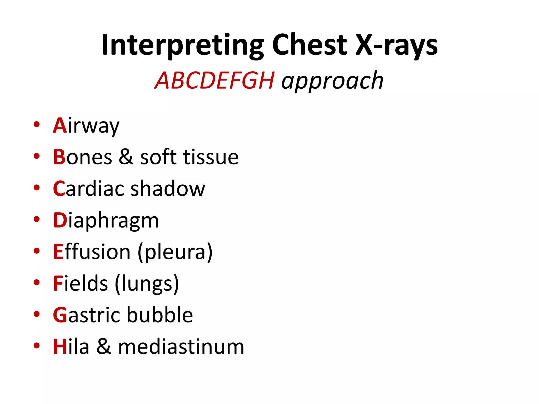 Chest X-rays for Undergraduates | PPTX