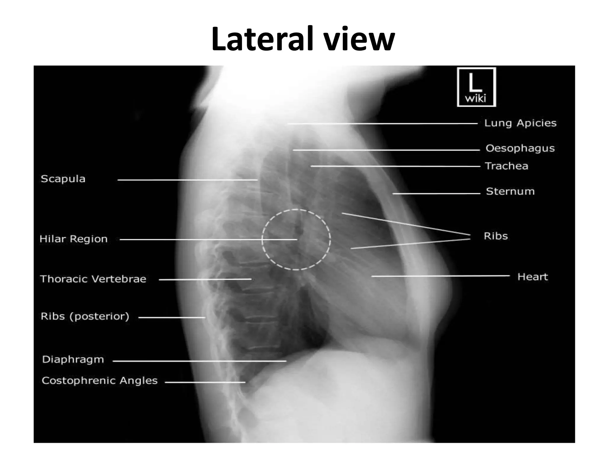Chest X-rays for Undergraduates | PPTX