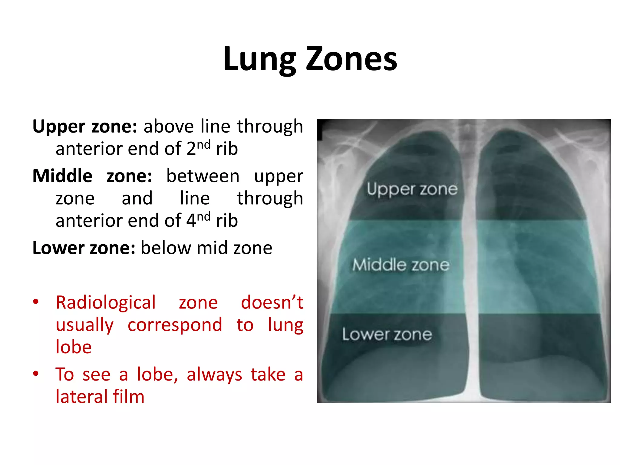 Chest X-rays for Undergraduates | PPTX