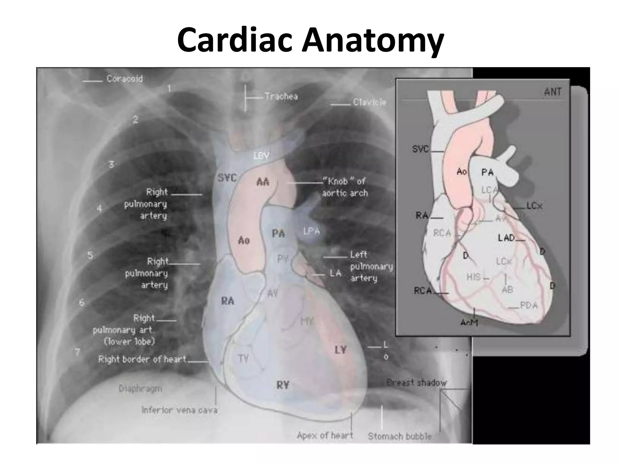 Chest X-rays for Undergraduates | PPTX