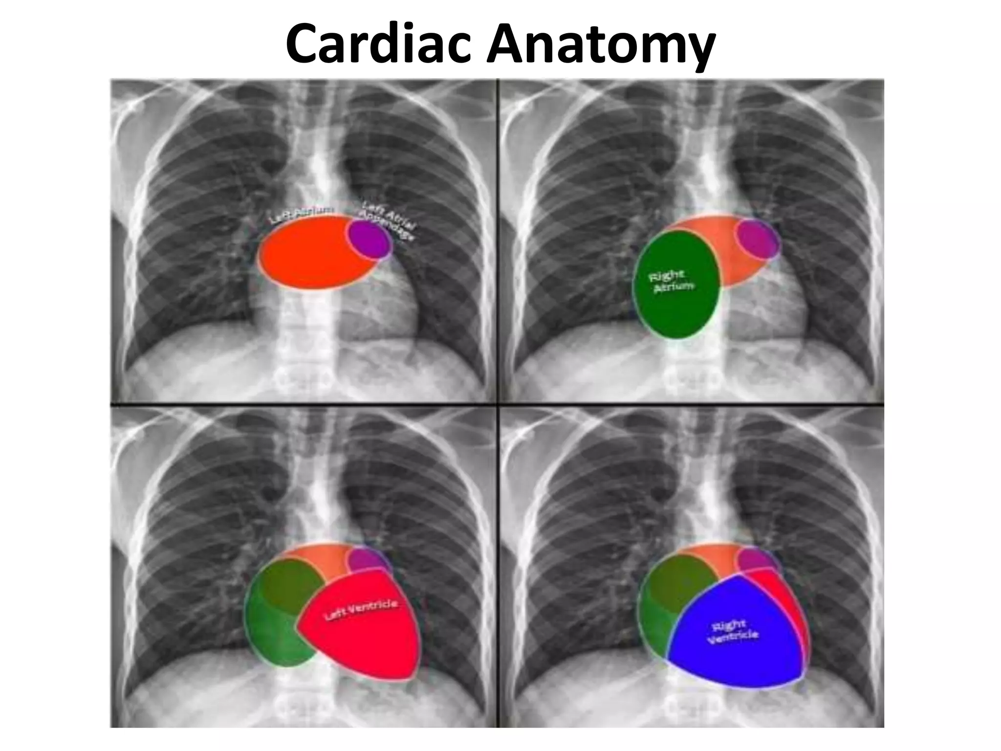 Chest X-rays for Undergraduates | PPTX