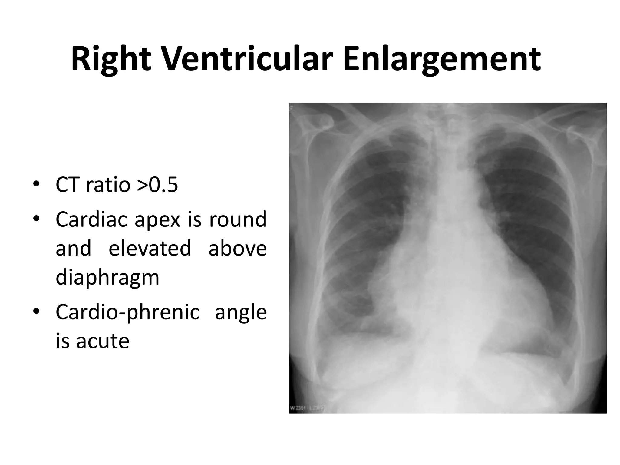 Chest X-rays for Undergraduates | PPTX