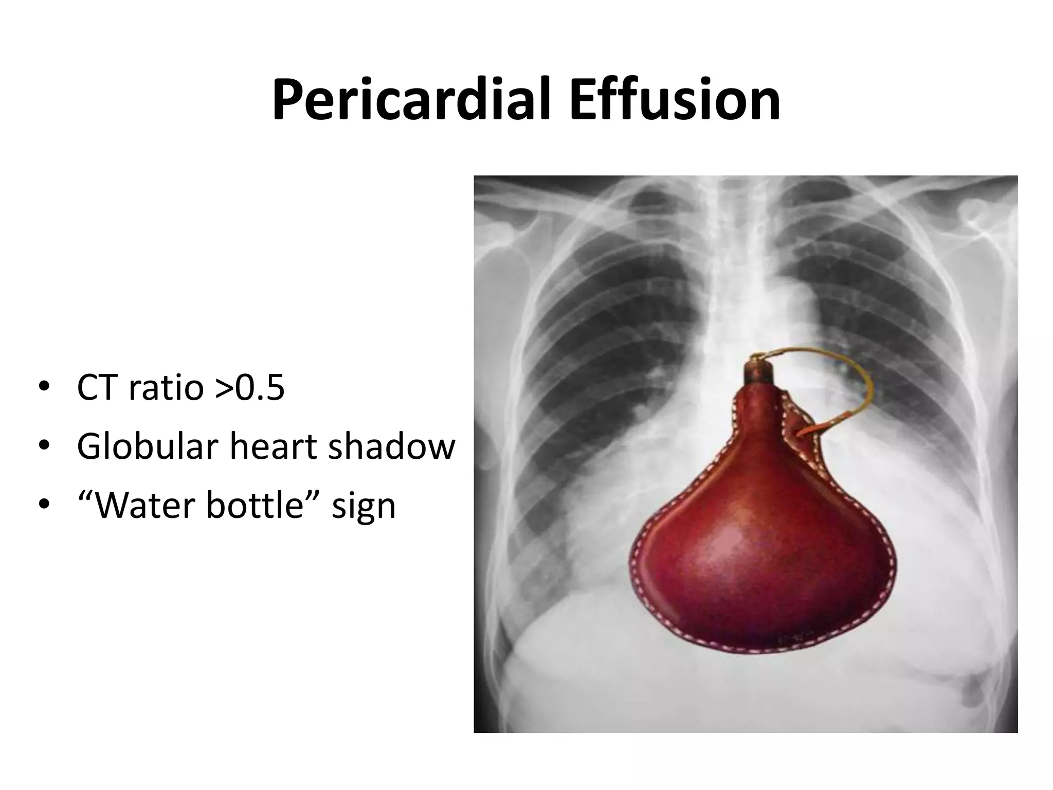 Chest X-rays for Undergraduates | PPTX