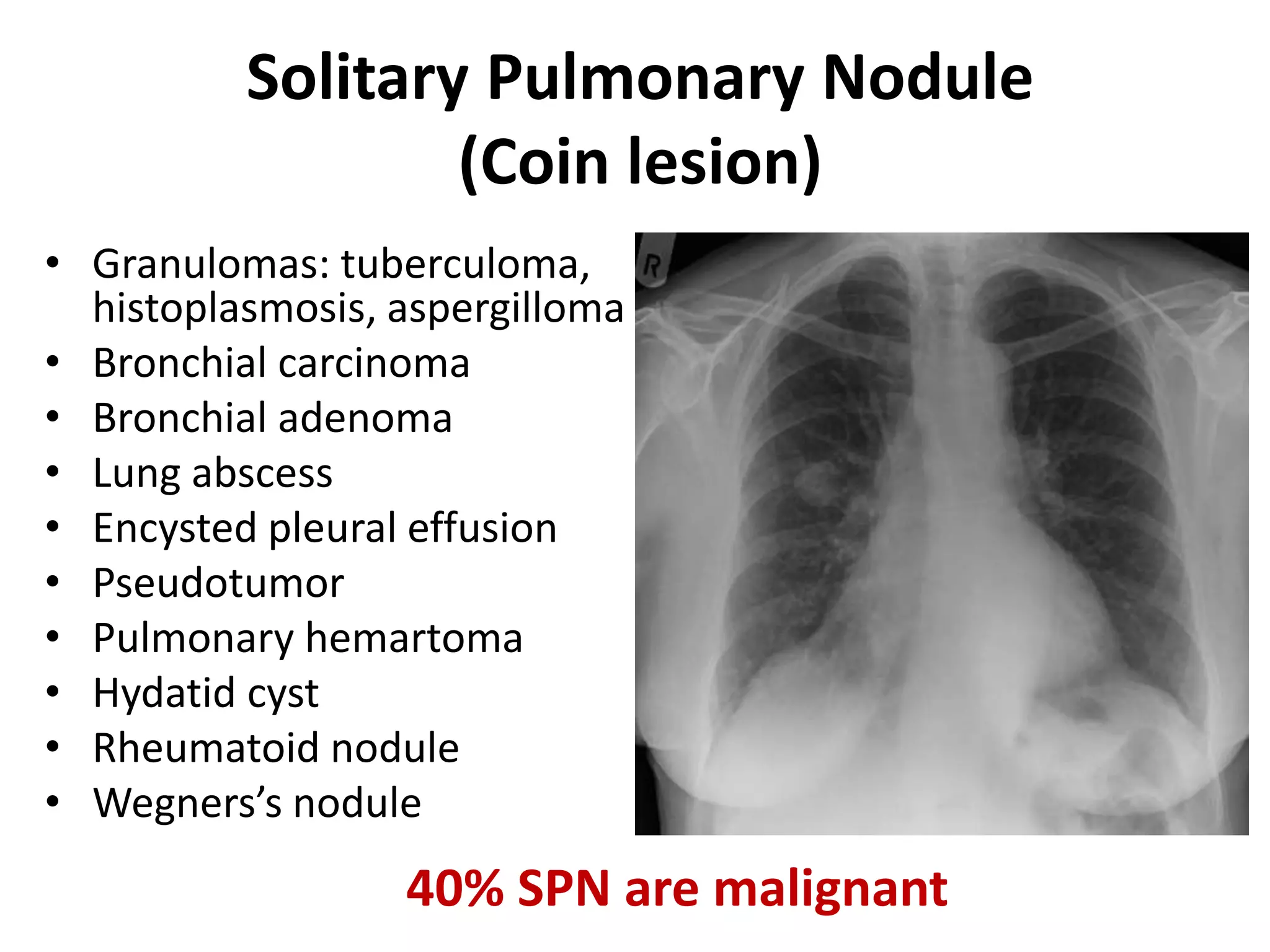 Chest X-rays for Undergraduates | PPTX