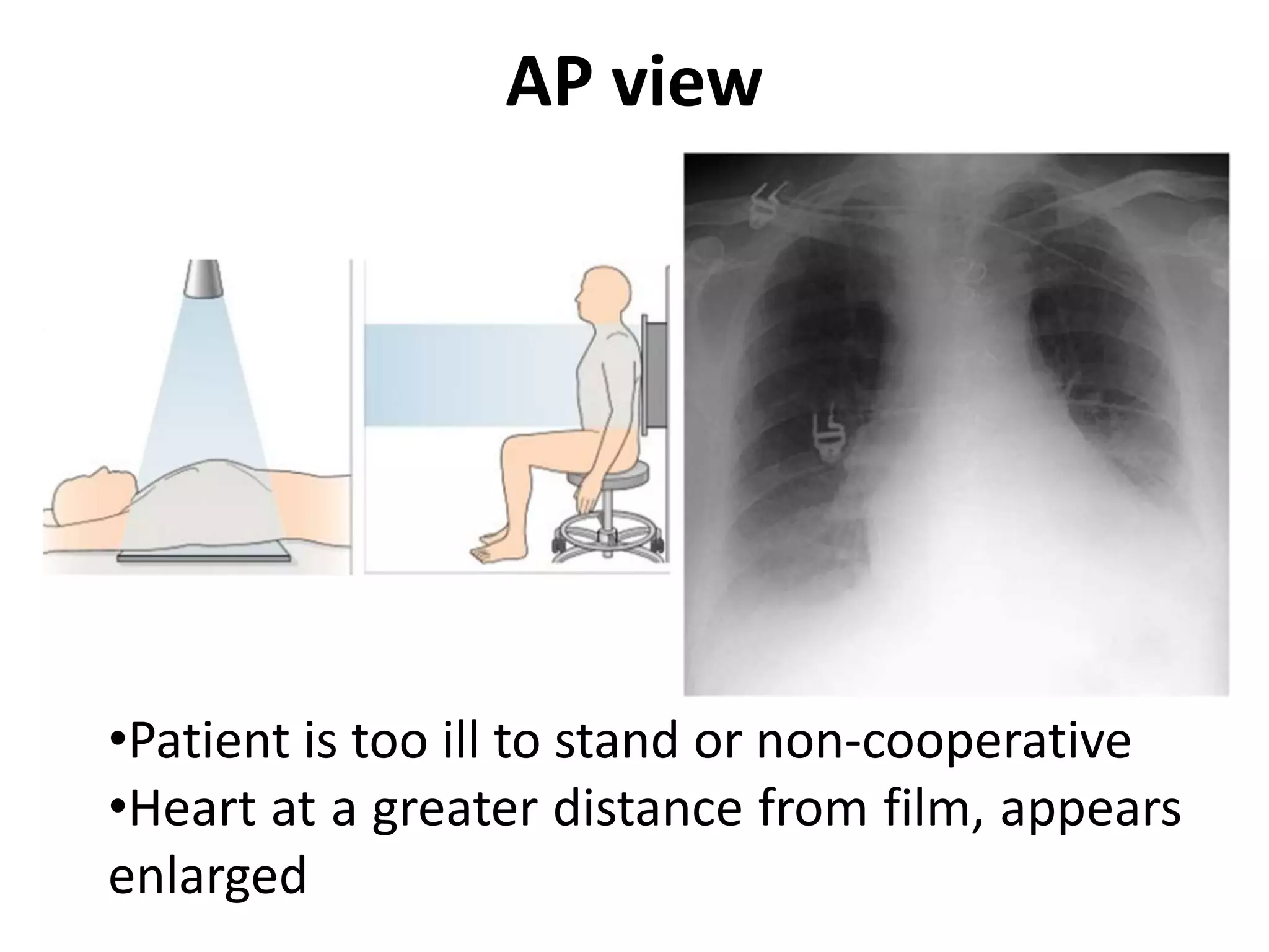 Chest X-rays for Undergraduates | PPTX