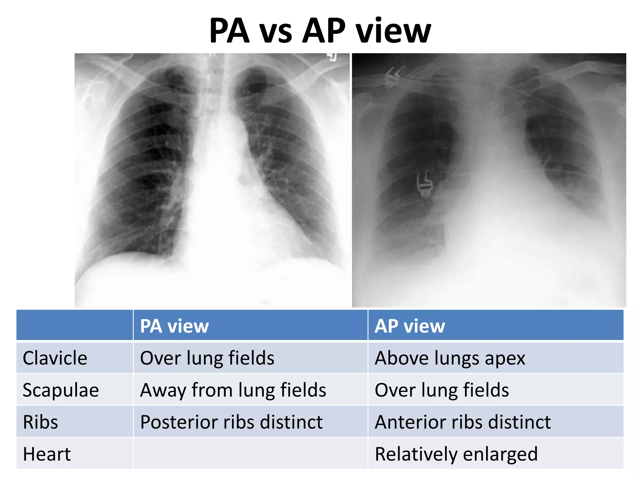 Chest X-rays for Undergraduates | PPTX