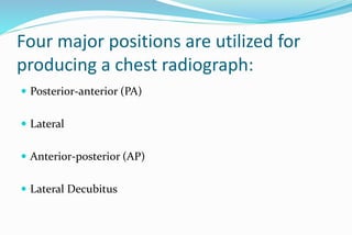 Chest x ray | PPTX