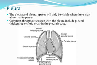 Chest x ray | PPTX