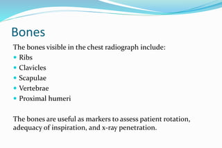 Chest x ray | PPTX