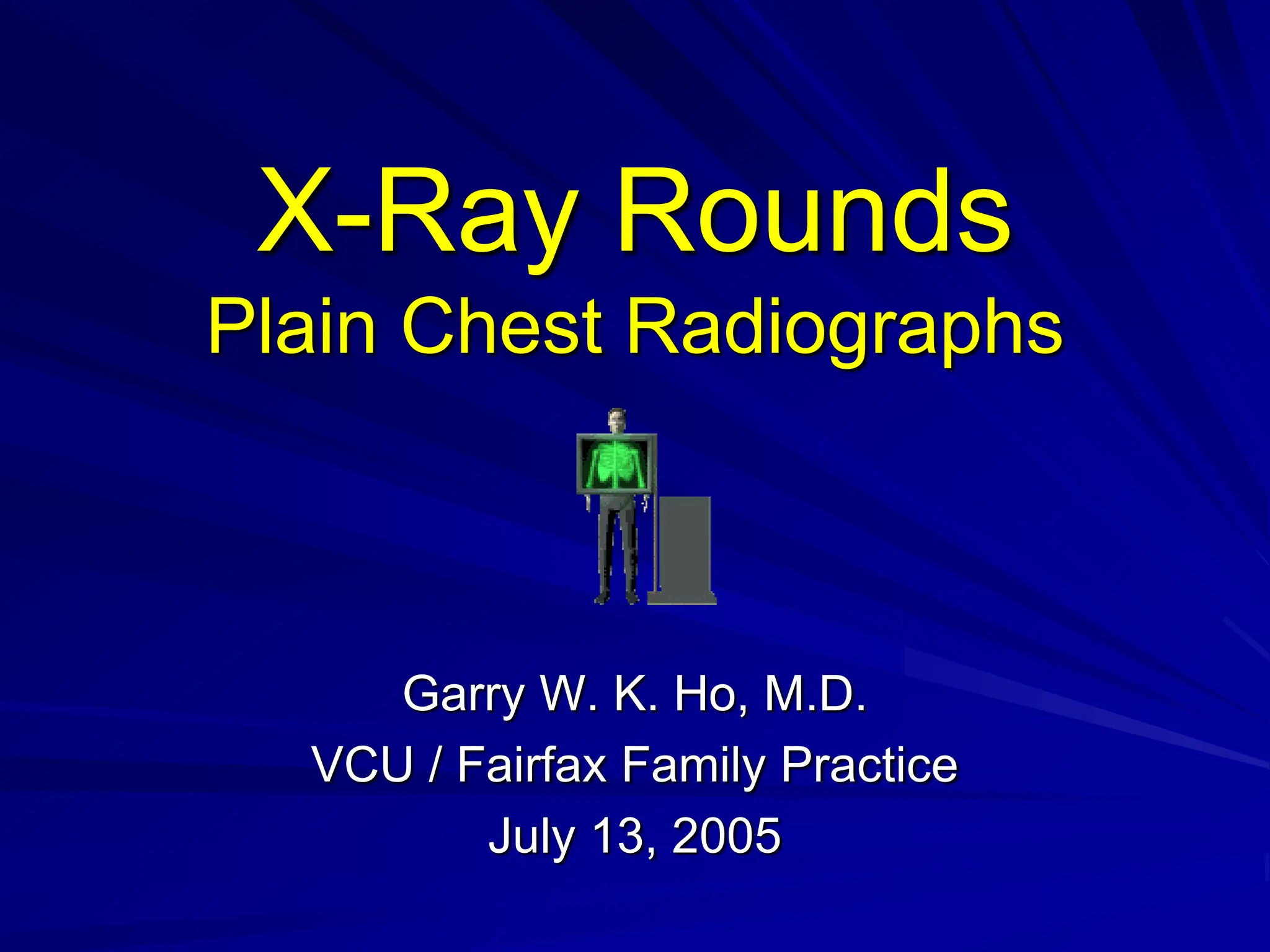 ChestX-Rays.ppt