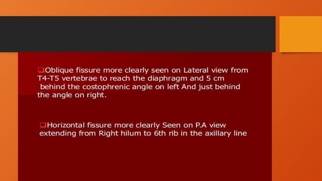 Chest X-Rays.pptx.. Mbbs final year ppts | PPTX