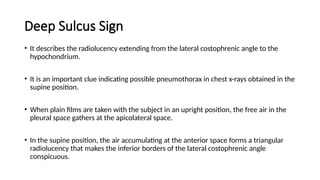 Chest x-ray INTERPRETATION AND signs.pptx