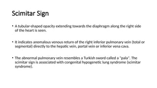 Chest x-ray INTERPRETATION AND signs.pptx