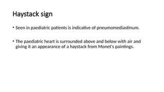 Chest x-ray INTERPRETATION AND signs.pptx