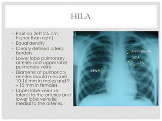 Normal Chest X-ray | PPTX