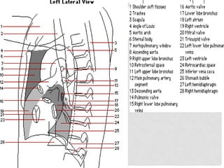 Normal Chest X-ray | PPTX