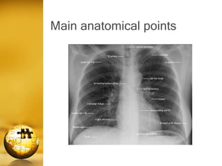 Chest x ray basic knowledge | PPTX