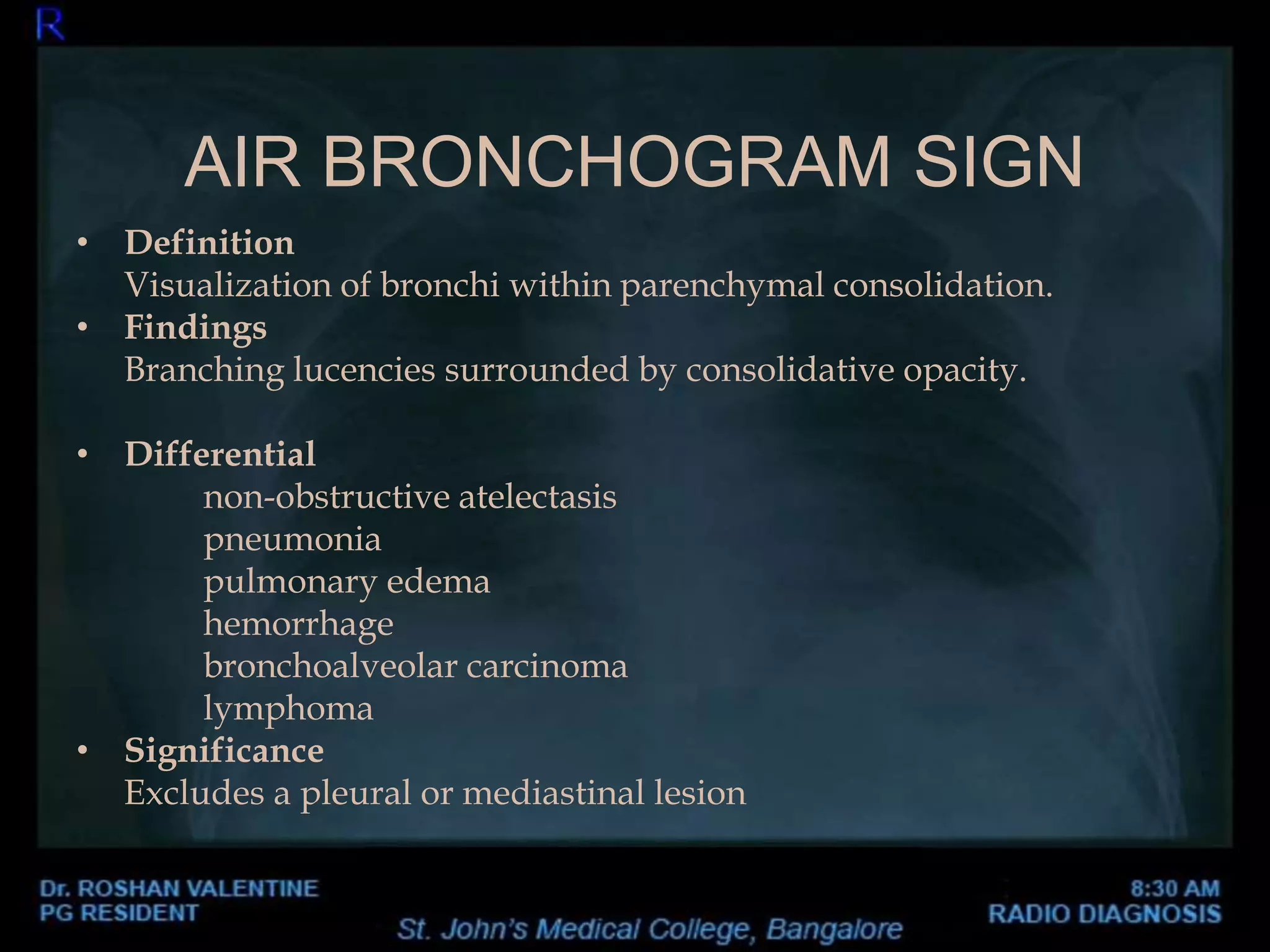 Abnormal Chest xray | PPTX