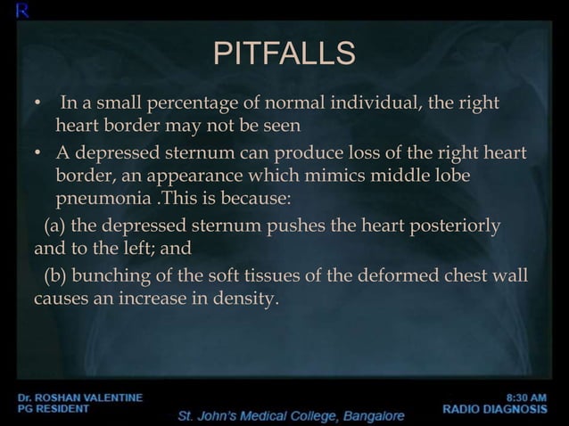 Abnormal Chest xray | PPTX