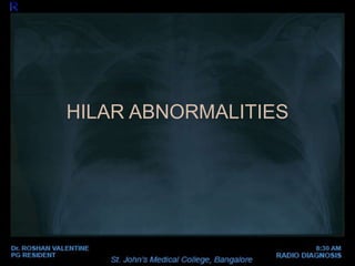 Abnormal Chest xray | PPTX